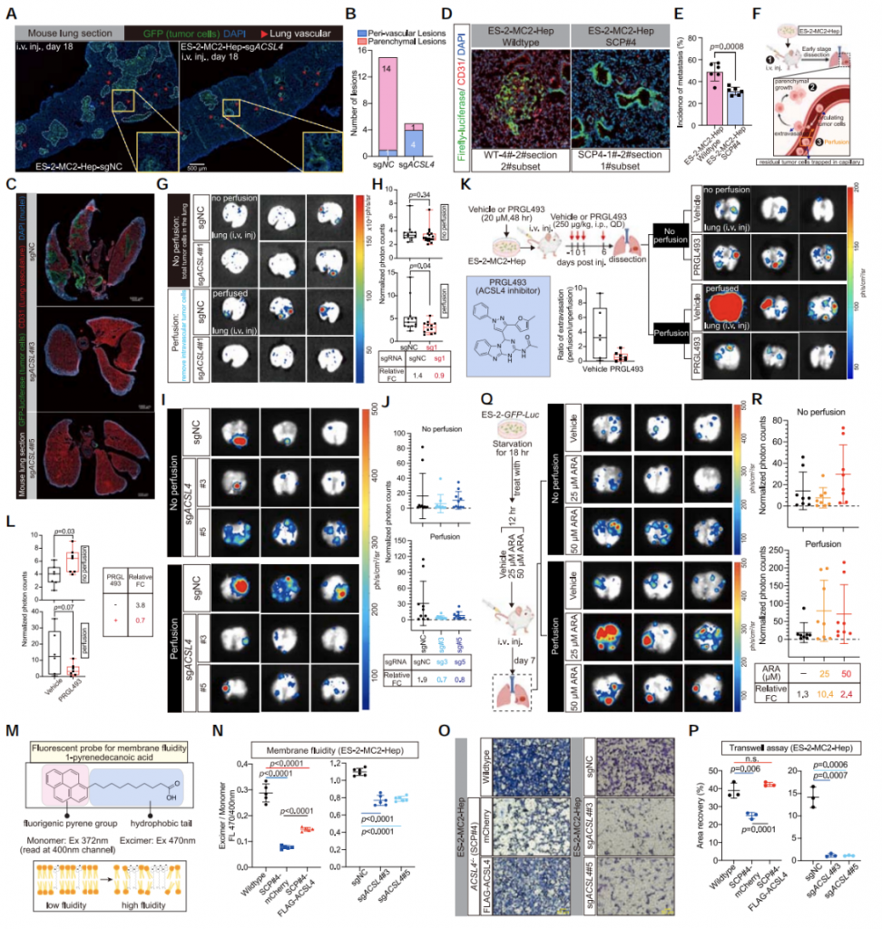 Cell | 长链酯酰辅酶A合成酶ACSL4 携手多不饱和脂质：为癌细胞转移性“大迁徙”开启“绿色通道”_肿瘤细胞_氨基酸代谢_非靶向代谢_脂质_多组学代谢流检测分析_脂肪酸定量_肠道微生物菌 ...